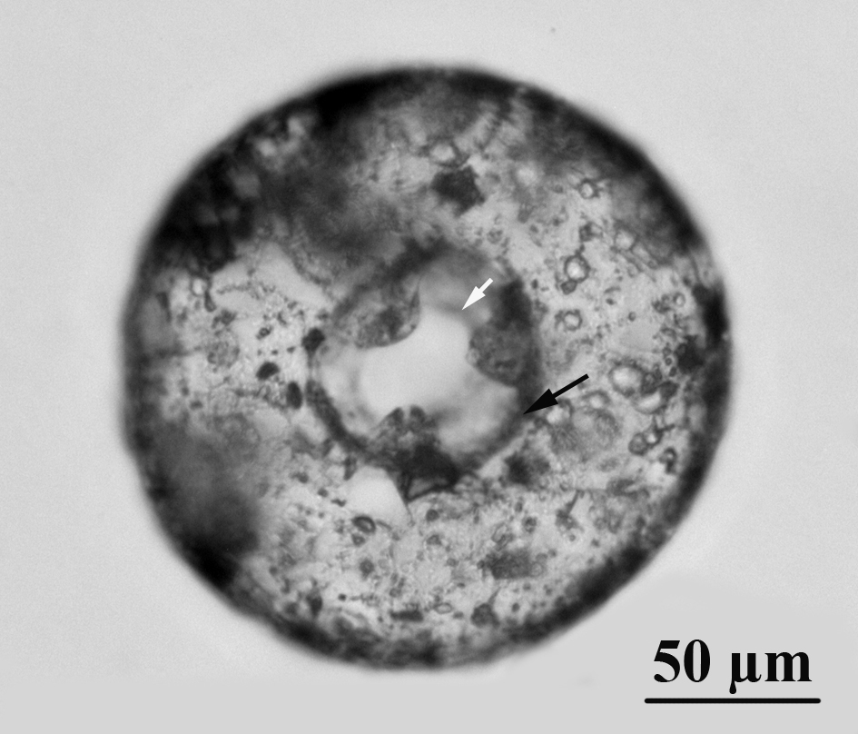 On the morphology, biometry and biogeography of Lamtopyxis callistoma ...