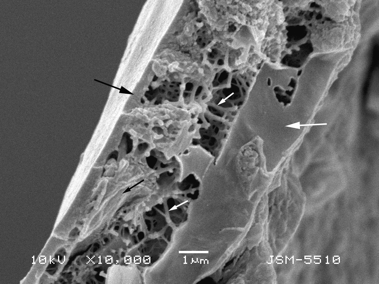On the morphology, biometry and biogeography of Lamtopyxis callistoma ...